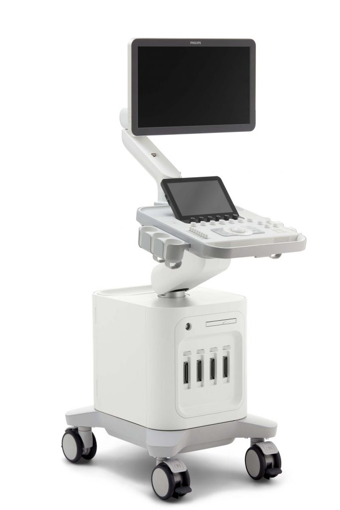 Philips introduces breakthrough Ultrasound 3300 system in India for ...
