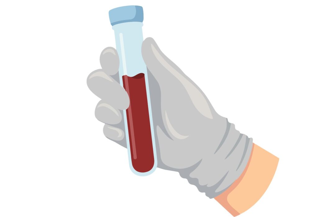 AST in Blood Tests Explained: What Your Levels Really Mean